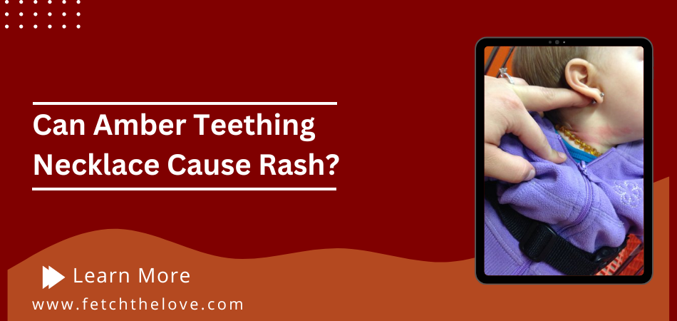 Can Amber Teething Necklace Cause Rash? – Fetchthelove Inc.